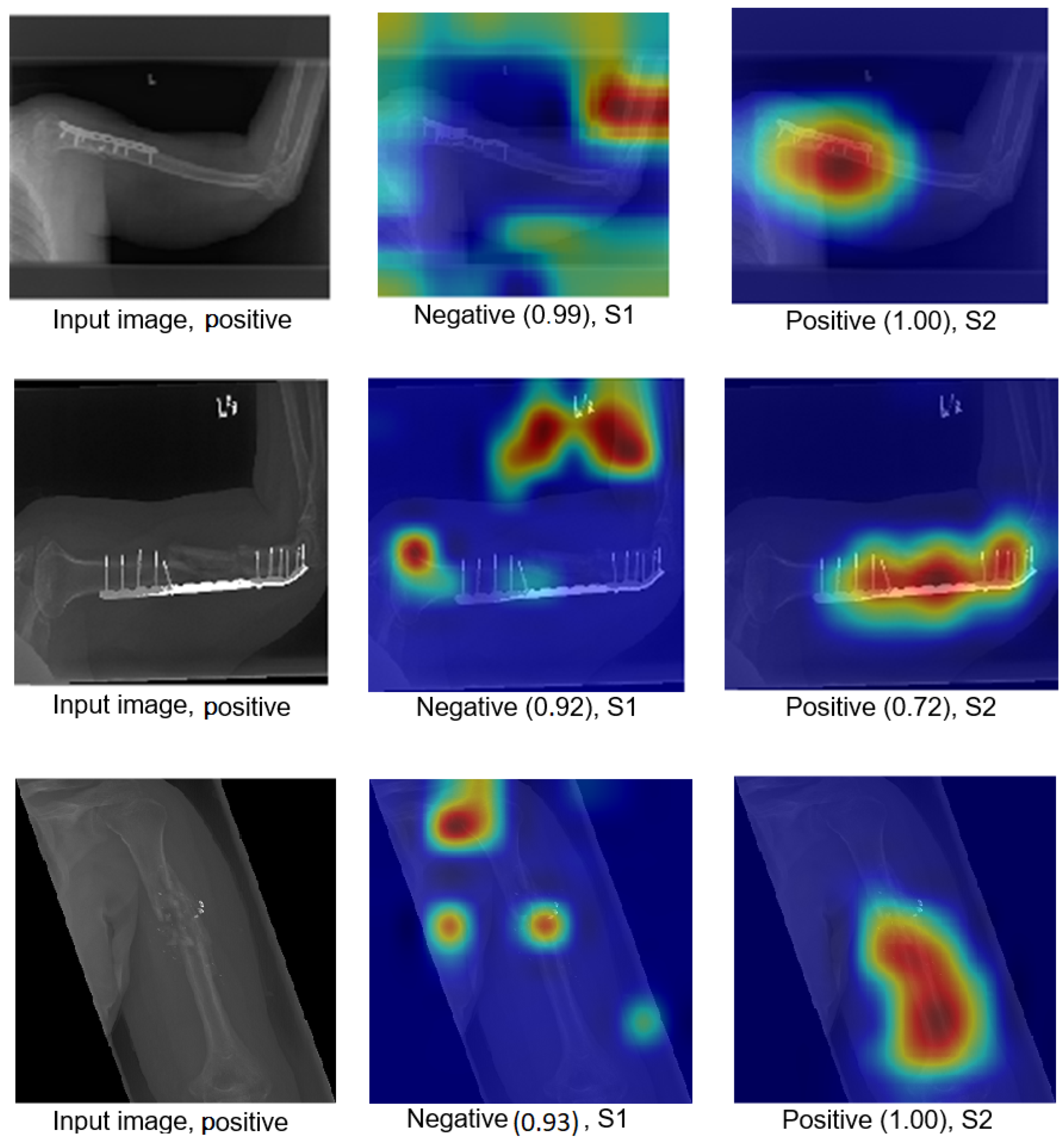 Deep Transfer Learning with Enhanced Feature Fusion for Detection of ...