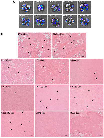 Luciferase Expressing Preclinical Model Systems Representing the Different Molecular Subtypes of ...