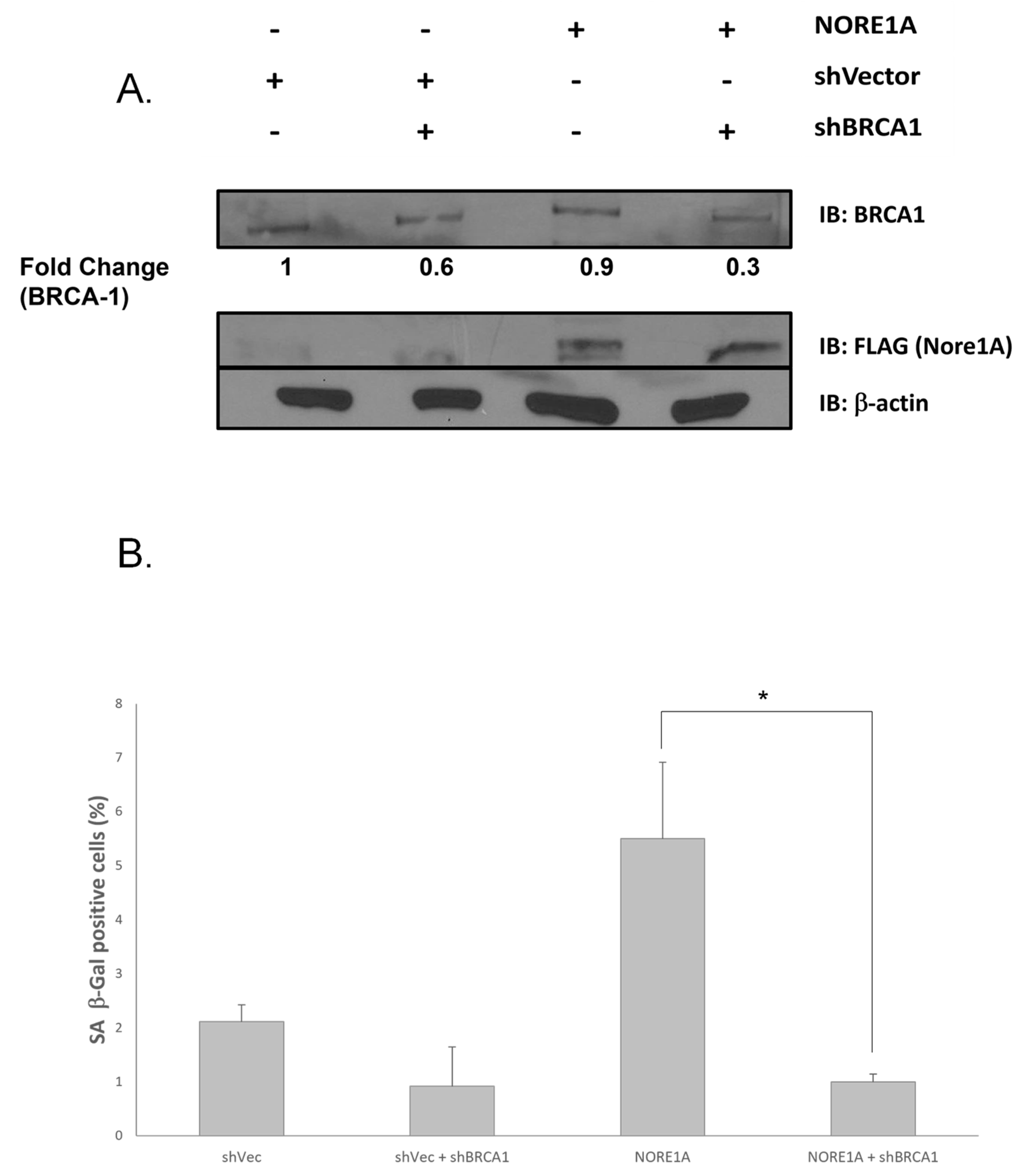 BRCA1 and NORE1A Form a Her2/Ras Regulated Tumor Suppressor Complex Modulating Senescence