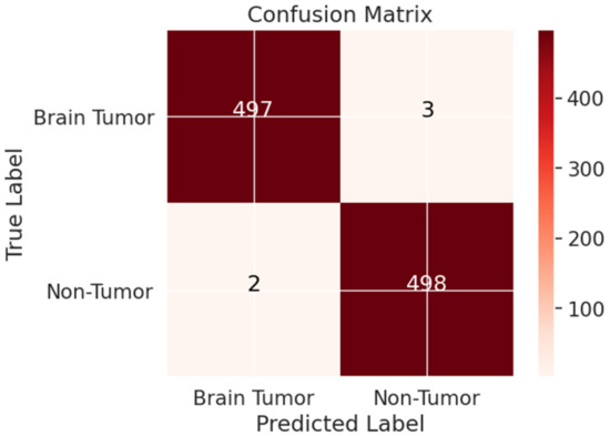 Brain Tumor Detection Based on Deep Learning Approaches and Magnetic ...
