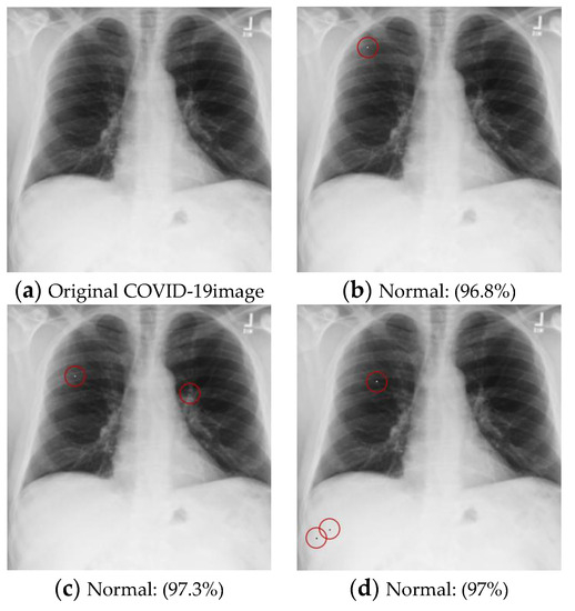 Adversarial Attacks on Medical Image Classification