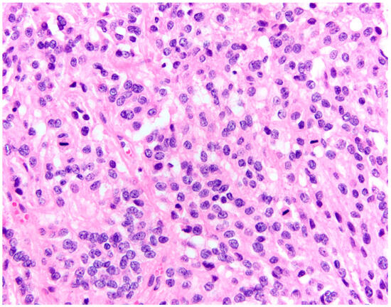 Cancers | Free Full-Text | Interdisciplinary Therapeutic Approaches to ...