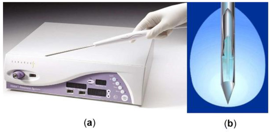 The Evolving Role of Cryosurgery in Breast Cancer Management: A ...