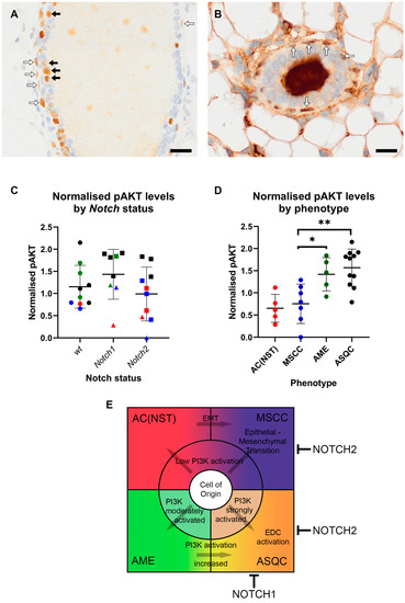 Cancers | Free Full-Text | NOTCH and AKT Signalling Interact to Drive ...