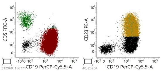 Atypical Chronic Lymphocytic Leukemia—The Current Status