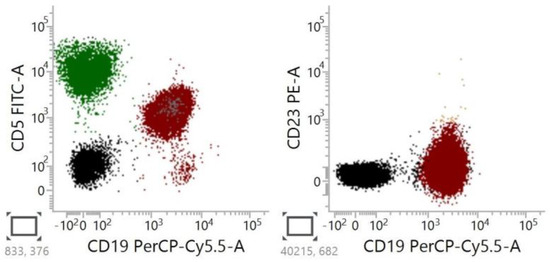 Atypical Chronic Lymphocytic Leukemia—The Current Status