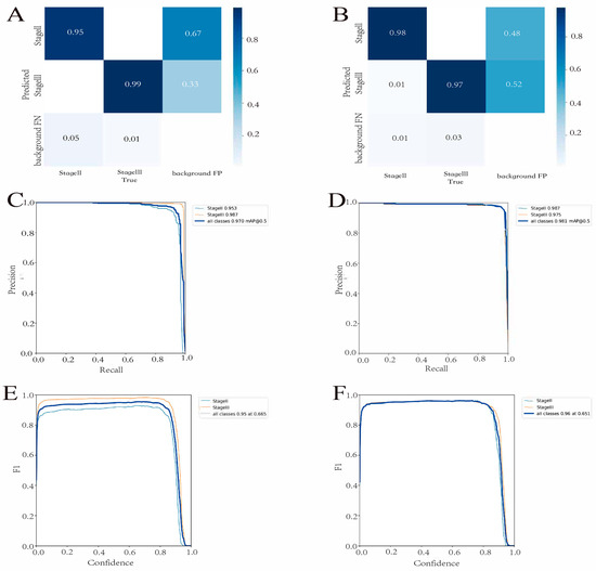 A Contrast-Enhanced CT-Based Deep Learning System for Preoperative ...