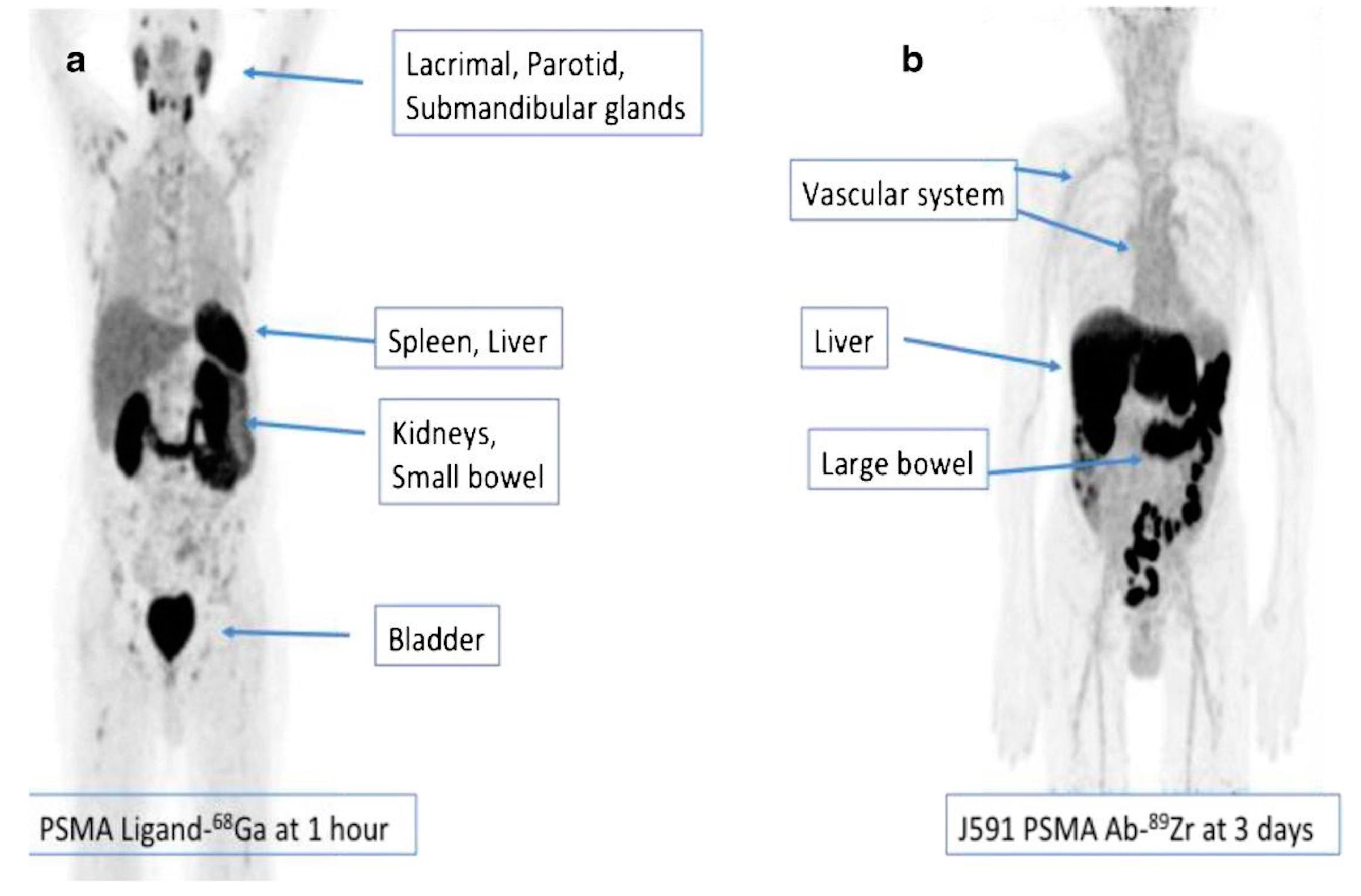 Current Status of Radiolabeled Monoclonal Antibodies Targeting PSMA for ...