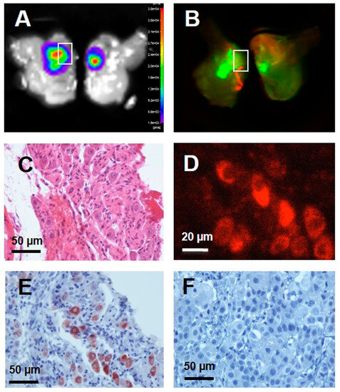 Current Status of Radiolabeled Monoclonal Antibodies Targeting PSMA for ...