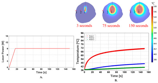 Development of a Treatment Planning Framework for Laser Interstitial ...