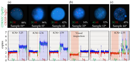 Cancers | Free Full-Text | Optical Genome Mapping Reveals the Complex ...
