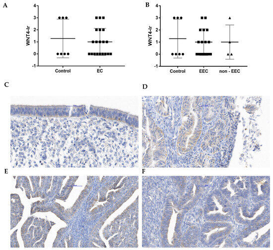 WNT4 Gene and Protein Expression in Endometrial Cancer and Its Significance