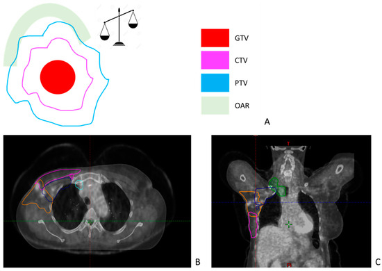 Cancers | Free Full-Text | A Comprehensive Primer on Radiation Oncology ...