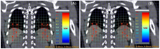 Cancers | Free Full-Text | Interplay Effect of Splenic Motion for Total ...