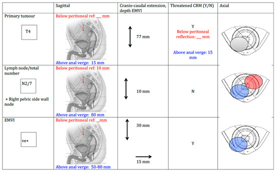 Cancers | Free Full-Text | Radiological Biomarkers in MRI directed Rectal Cancer Radiotherapy ...