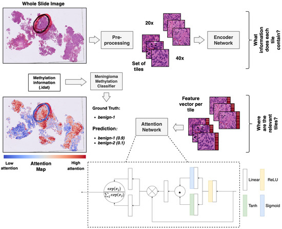 Leveraging Attention-Based Convolutional Neural Networks for Meningioma Classification in ...