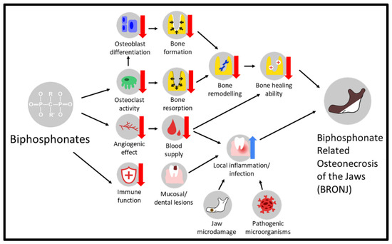Cancers | Free Full-Text | Bisphosphonates and Their Connection to ...