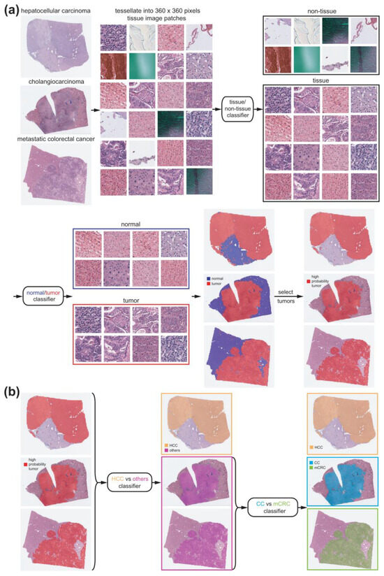 Deep Learning for the Pathologic Diagnosis of Hepatocellular Carcinoma, Cholangiocarcinoma, and ...