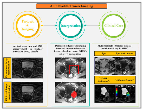Multiparametric MRI in Era of Artificial Intelligence for Bladder ...