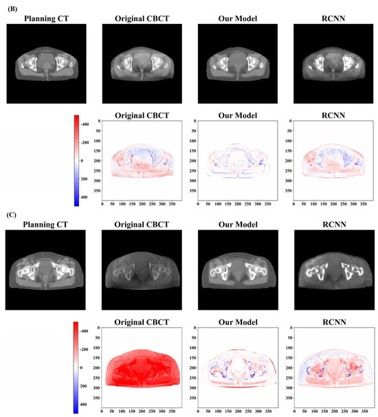 CBCT-to-CT Synthesis for Cervical Cancer Adaptive Radiotherapy via U ...