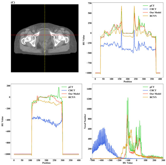 CBCT-to-CT Synthesis for Cervical Cancer Adaptive Radiotherapy via U ...