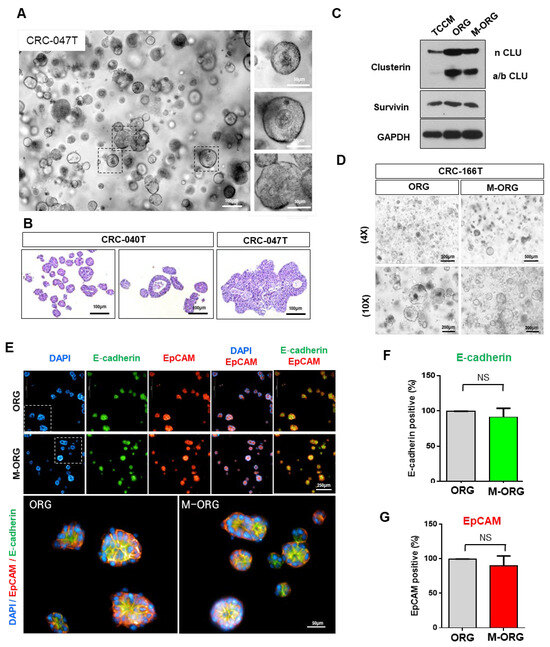 Improved Drug-Response Prediction Model of APC Mutant Colon Cancer ...