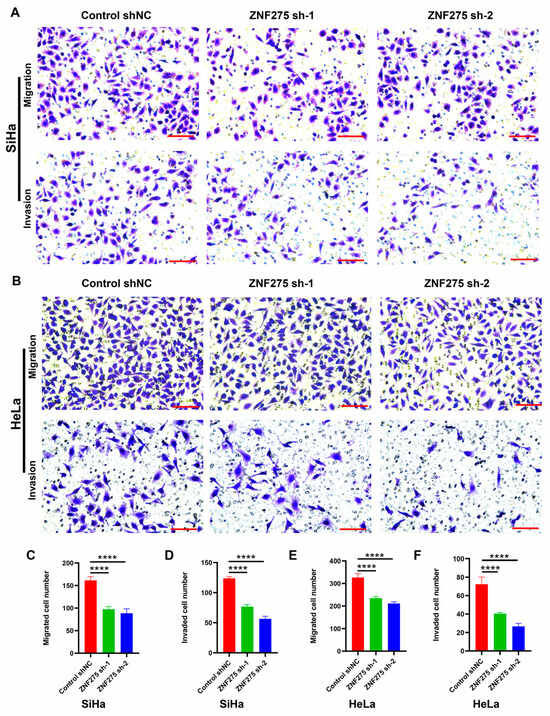 The Role of ZNF275/AKT Pathway in Carcinogenesis and Cisplatin ...