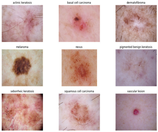 A Review of Recent Advances in Computer-Aided Detection Methods Using ...