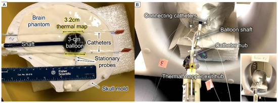 Evaluation of a Balloon Implant for Simultaneous Magnetic Nanoparticle ...