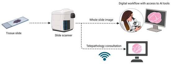 Breaking Barriers: AI’s Influence on Pathology and Oncology in Resource ...