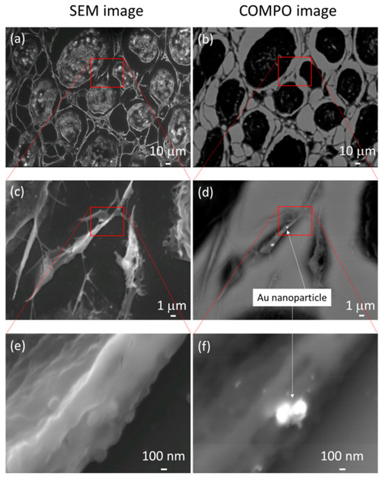 Gold Nanoparticles Enhance the Tumor Growth-Suppressing Effects of ...