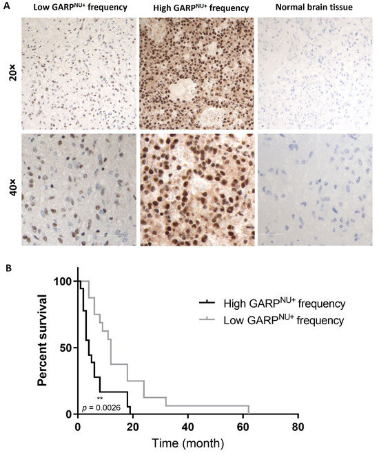 Nuclear Glycoprotein A Repetitions Predominant (GARP) Is a Common Trait ...