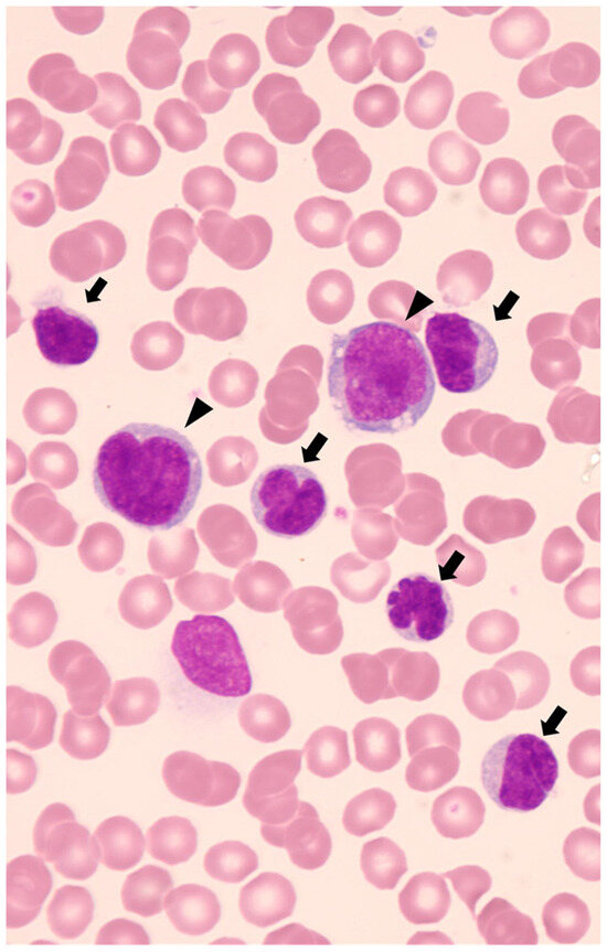 Cancers | Free Full-Text | Strategy for Pediatric Patients with ...