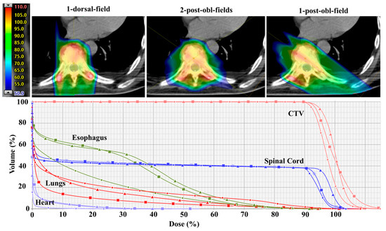Dosimetric Comparison of Conventional Radiotherapy, Volumetric ...