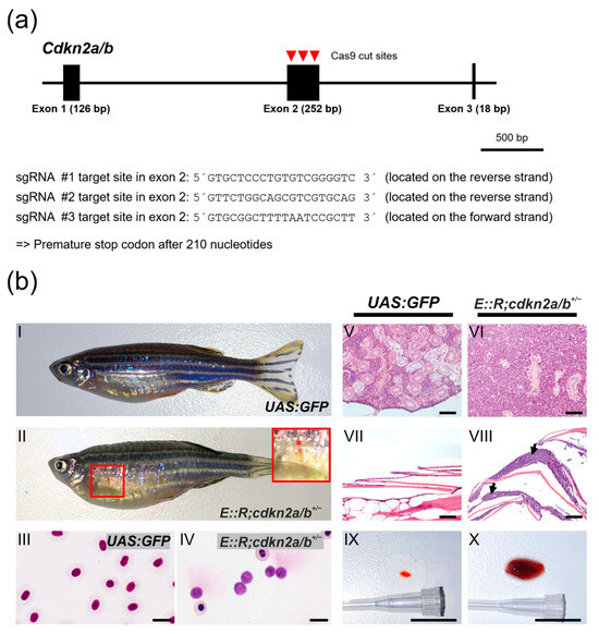 Generation of a Zebrafish Knock-In Model Recapitulating Childhood ETV6::RUNX1-Positive B-Cell ...