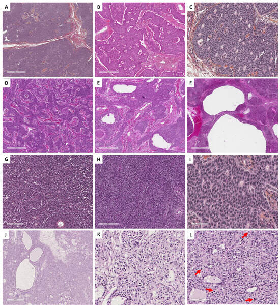 Cancers Free Full Text Relevance Of Molecular Pathology For The