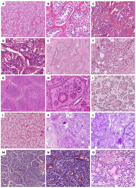 Cancers Free Full Text Relevance Of Molecular Pathology For The
