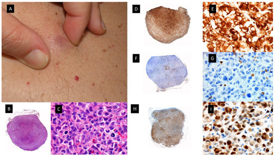 Cancers | Free Full-Text | Clinical, Histopathological and Molecular ...