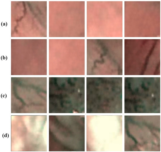 Cancers Free Full Text Automated Laryngeal Cancer Detection And Classification Using Dwarf