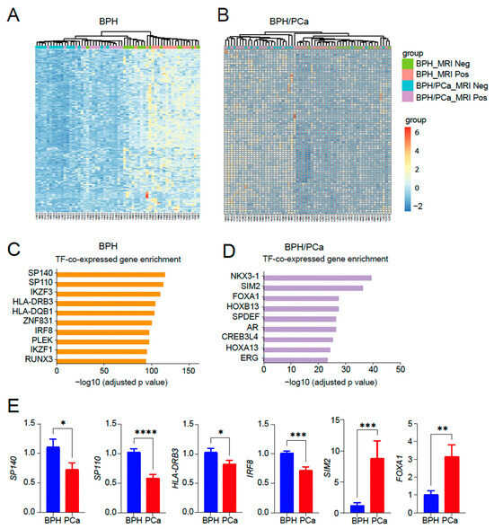 Symptomatic Benign Prostatic Hyperplasia with Suppressed Epigenetic ...