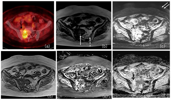 Evaluation of Three Imaging Methods to Quantify Key Events in Pelvic ...