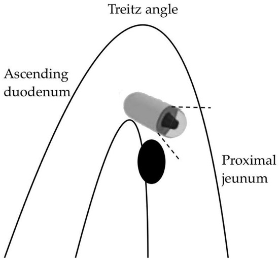 The Role of Capsule Endoscopy in the Diagnosis and Management of Small ...