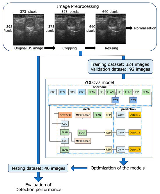 Metastatic Lymph Node Detection on Ultrasound Images Using YOLOv7 in Patients with Head and Neck ...