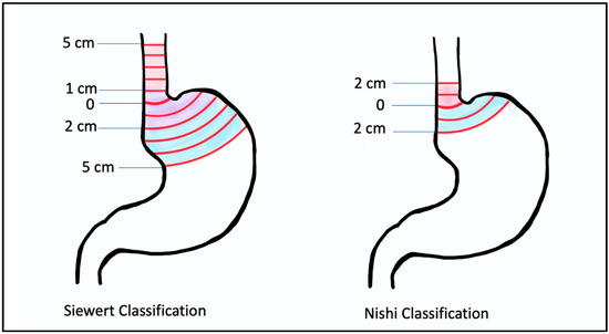 Cancers | Free Full-Text | The Multidisciplinary Approach and Surgical ...