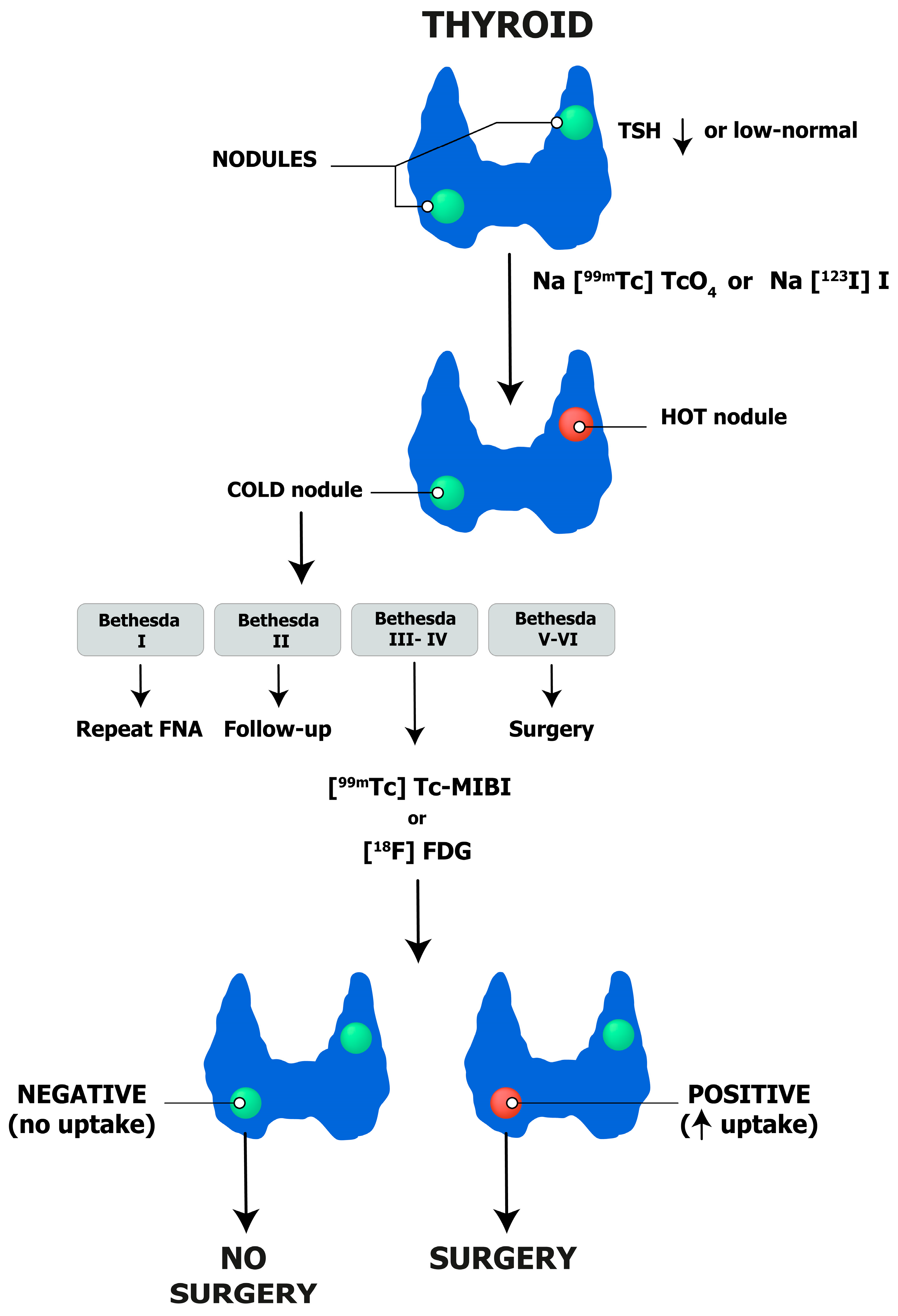 Integrated Diagnostics of Thyroid Nodules