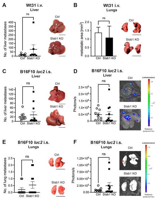 Deficiency of Stabilin-1 in the Context of Hepatic Melanoma Metastasis