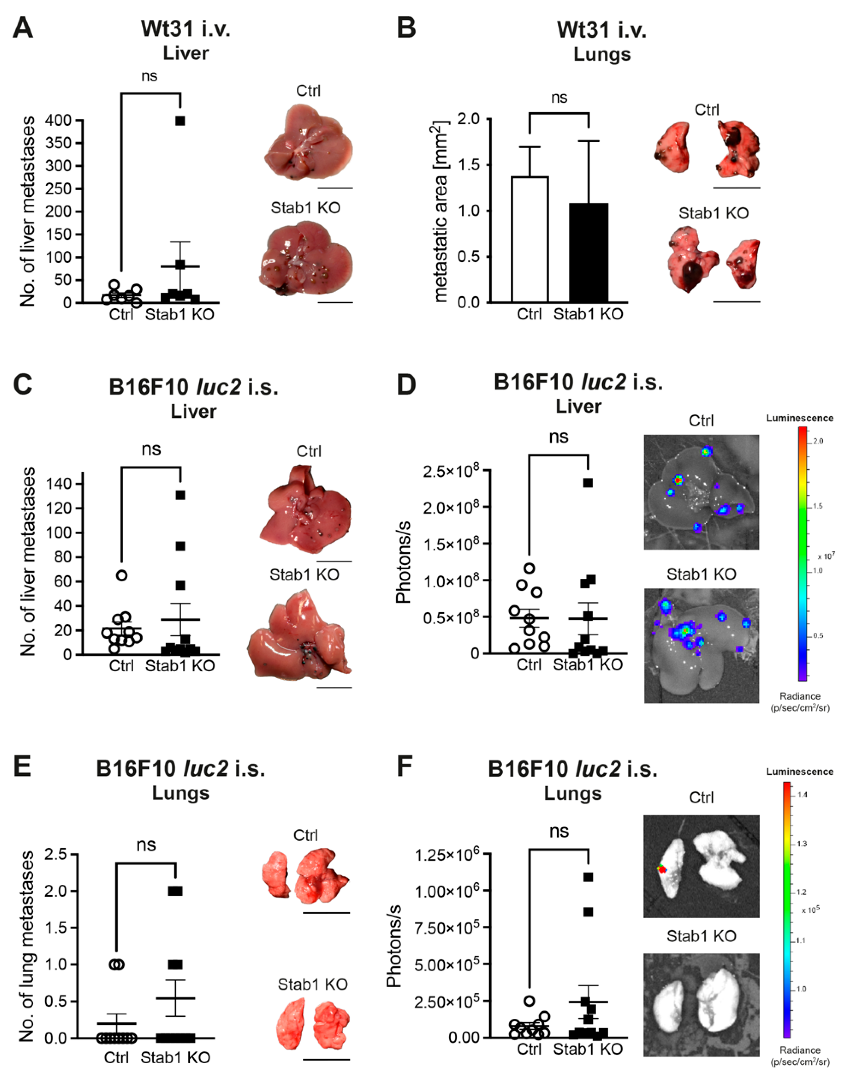 Deficiency of Stabilin-1 in the Context of Hepatic Melanoma Metastasis