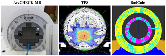 Cancers | Free Full-Text | Dose Calculation Accuracy of Beam Models in ...
