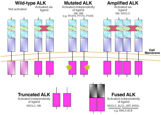 Anaplastic Lymphoma Kinase (ALK) in Posterior Cranial Fossa Tumors: A ...