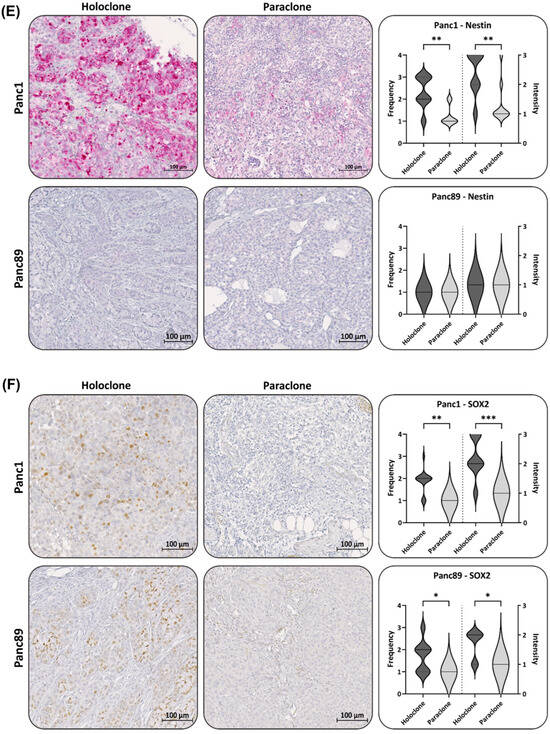 Cancers | Free Full-Text | Epithelial and Mesenchymal-like Pancreatic ...